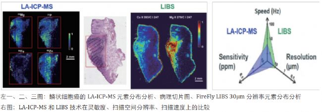 FireFly LIBS元素分布成像快速测量系统在医学和动物中的应用_生物器材网